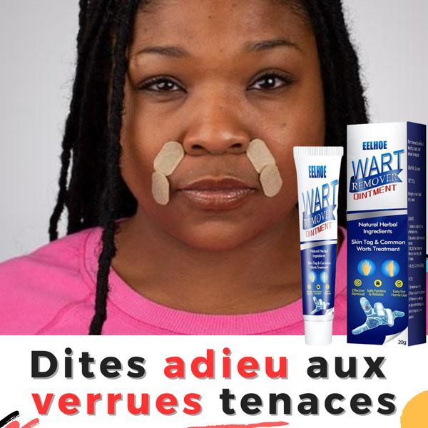 Crème Anti-Verrues – DENCIO SHOP